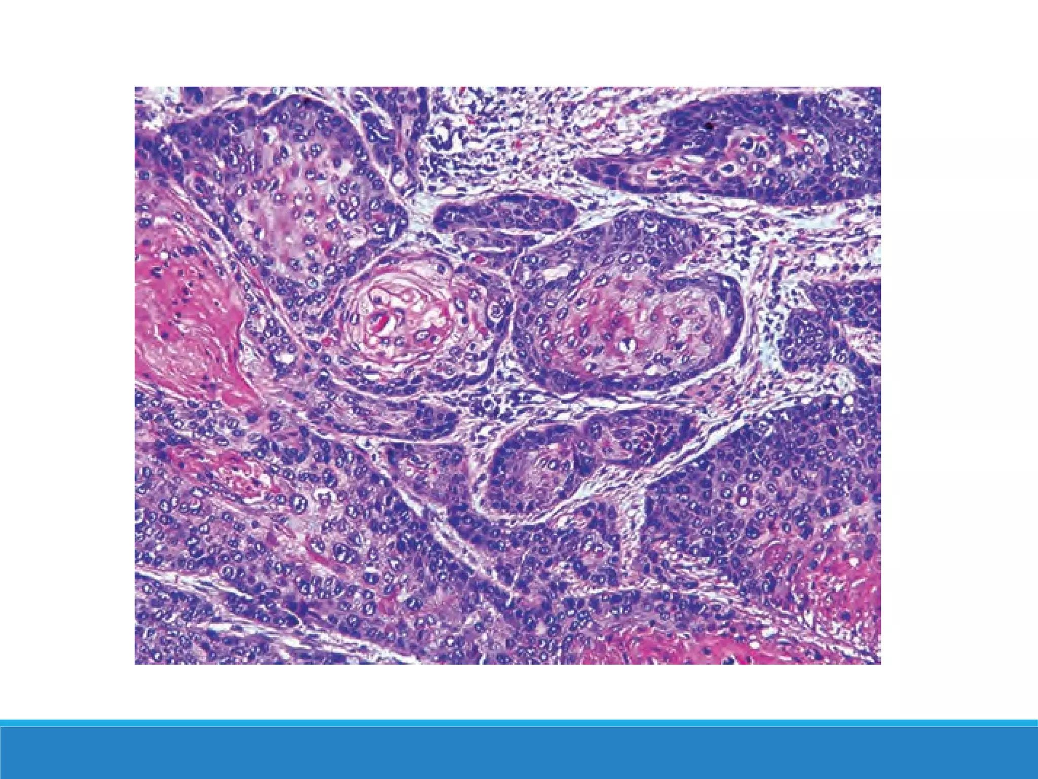 Pathology Of Cervix Ppt