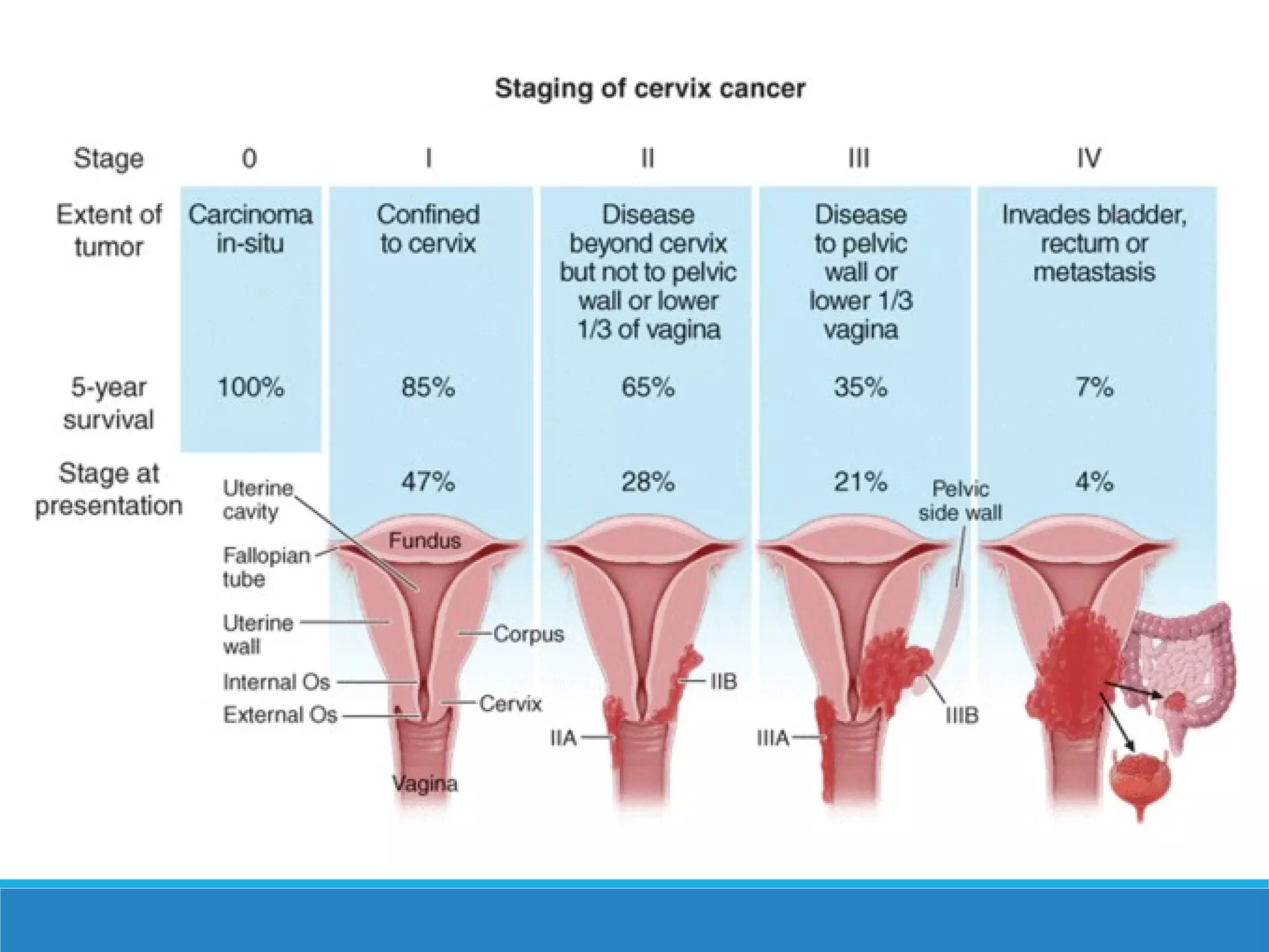 Pathology Of Cervix Ppt