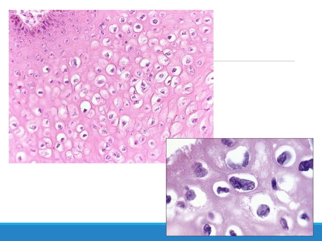Pathology of Cervix | PPT
