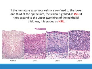 Pathology of Cervix | PPT