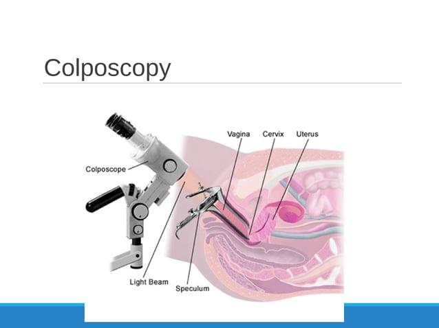 Pathology Of Cervix Ppt