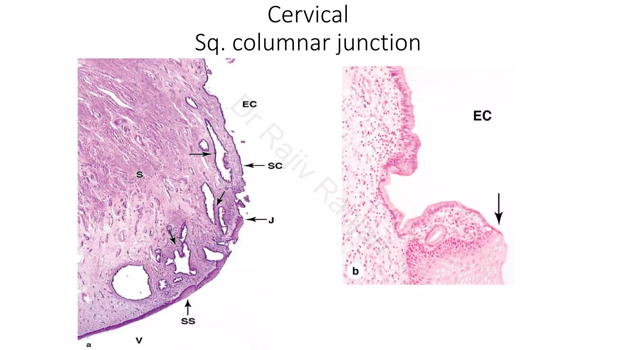 Histology of Cervix and vagina | PDF