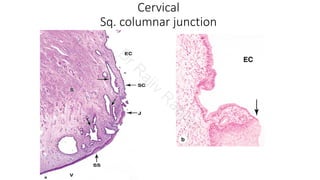 Histology of Cervix and vagina | PDF