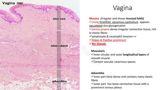 Histology Of Cervix And Vagina