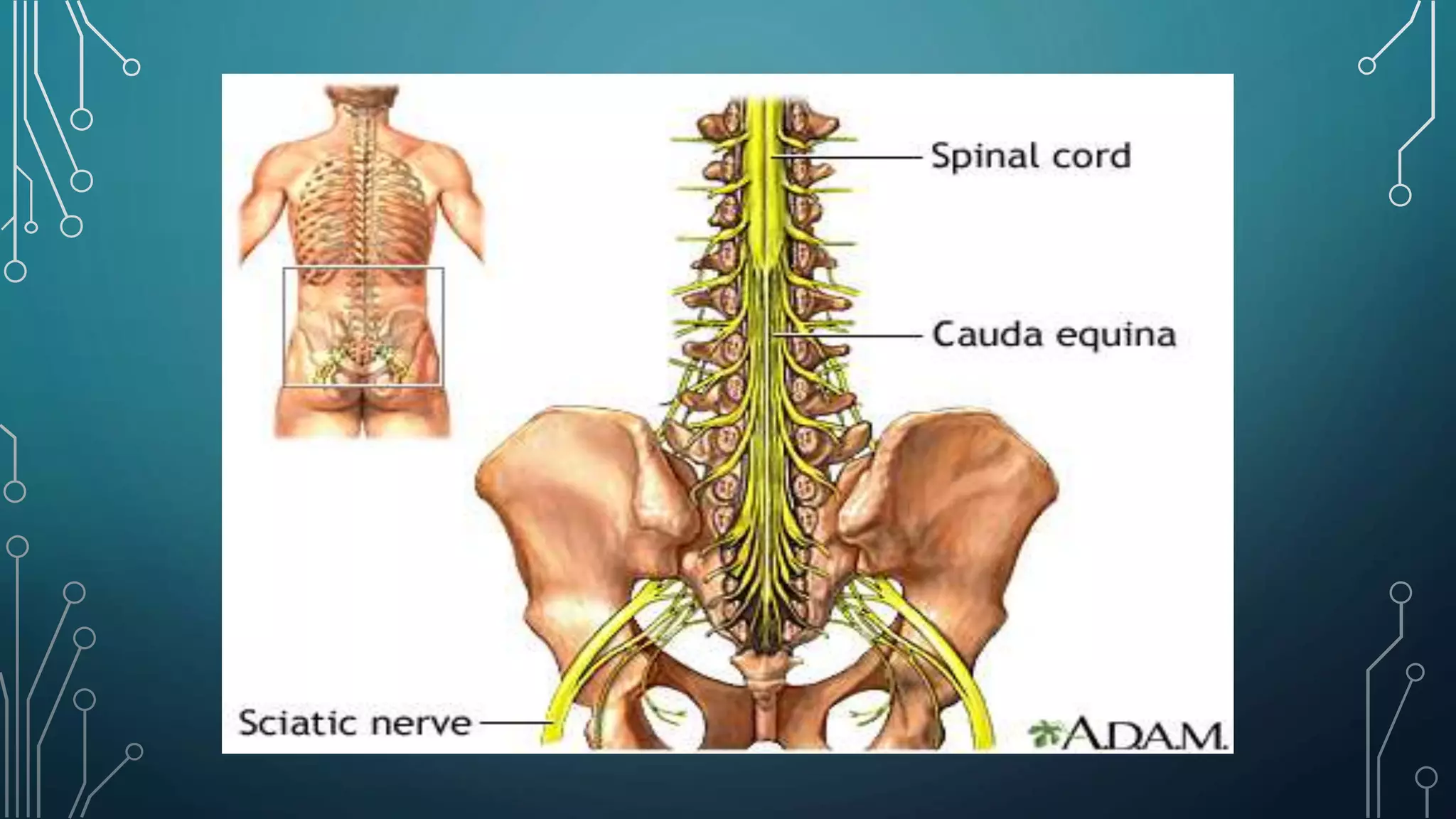 Cauda equina syndrome | PPTX