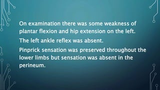 Cauda equina syndrome | PPTX