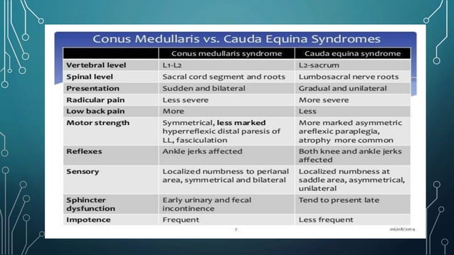 Cauda equina syndrome | PPTX