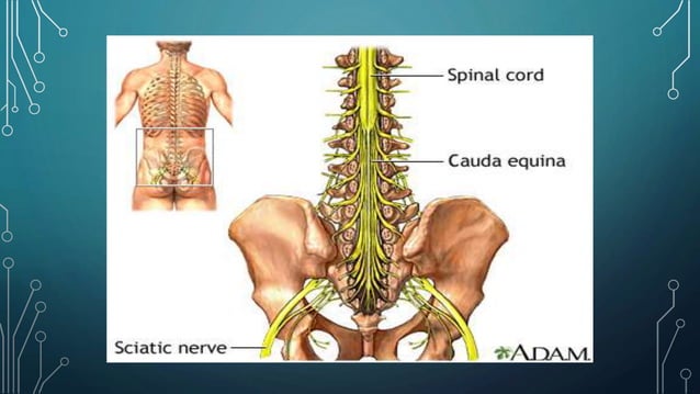 Cauda equina syndrome | PPTX