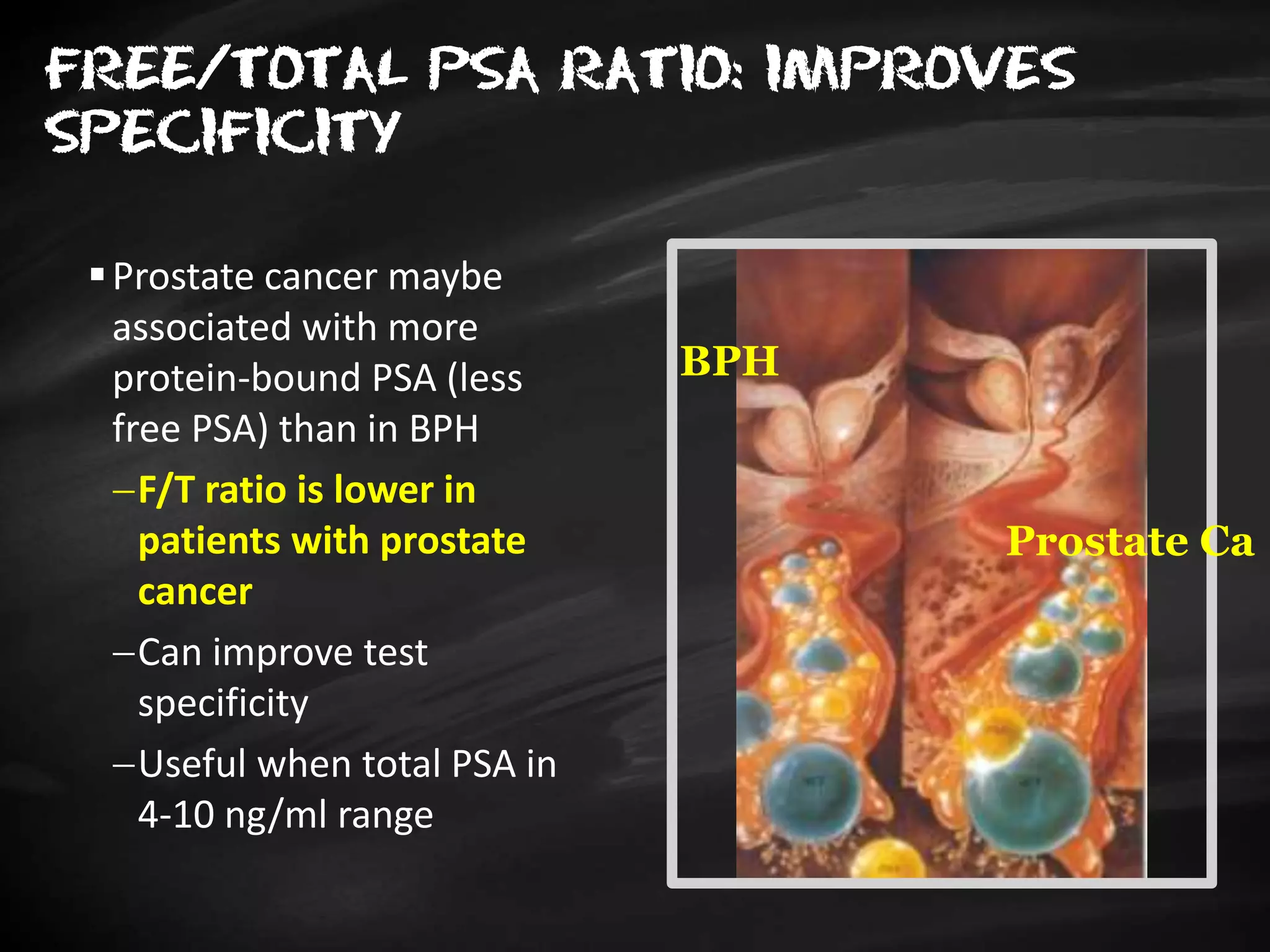 CES2018-01: Cáncer de próstata | PPTX