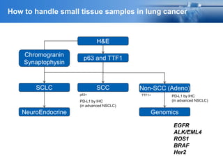CES201901: Lung cancer toolkit | PPT