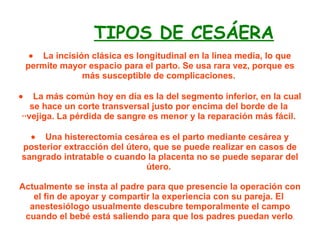 Cesarea | ODP