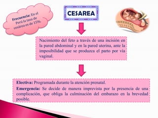 Cesarea Pptx