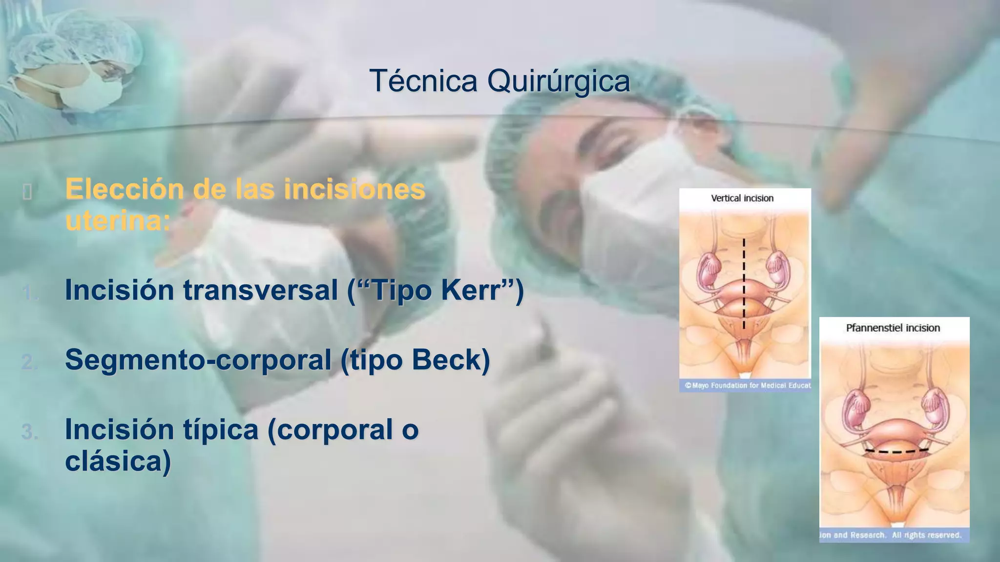Cesarea | PPTX