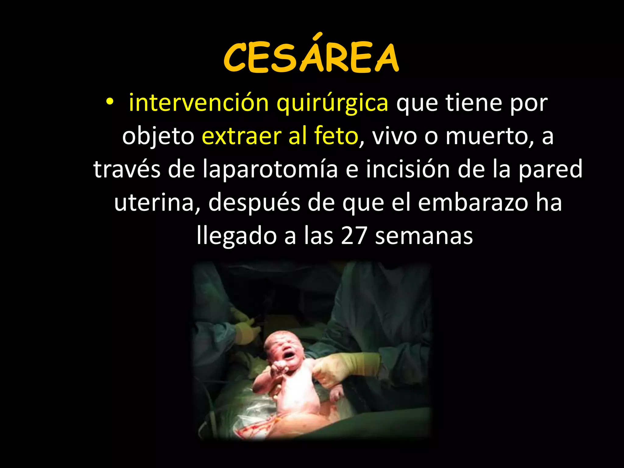 Cesarea | PPT