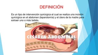 Cesarea | PPTX