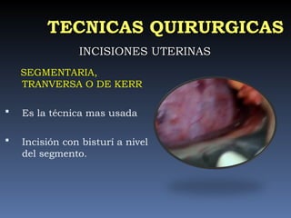 OBSTETRICIA DE LA CESARIA - PROCEDIMIENTOS DE CIRUGIA | PPT