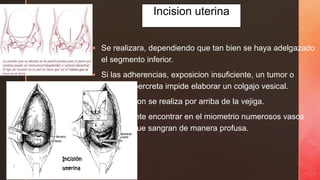 Cesarea | PPTX