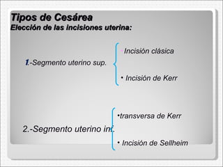 Cesarea Ppt