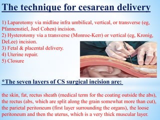 Cesarean section | PDF
