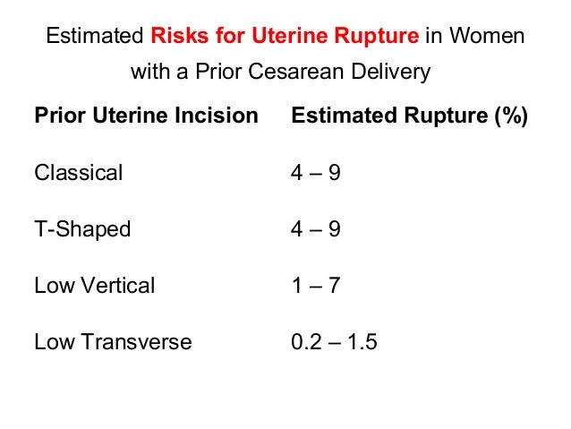 Cesarean Delivery