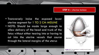Cesarean Delivery | PDF | Pregnancy | Reproductive Health
