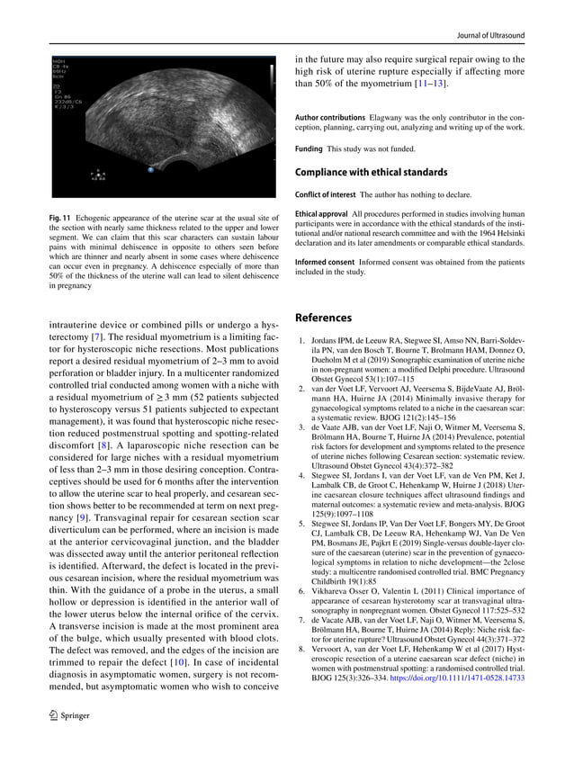 Cesarean scar defects | PDF