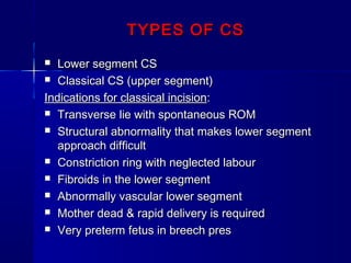 Cesarean section | PPT