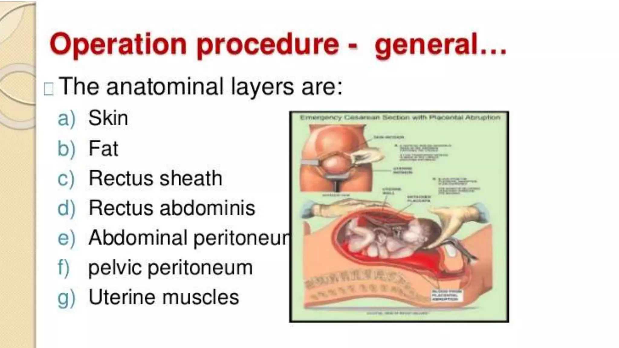cesarean section.pptx