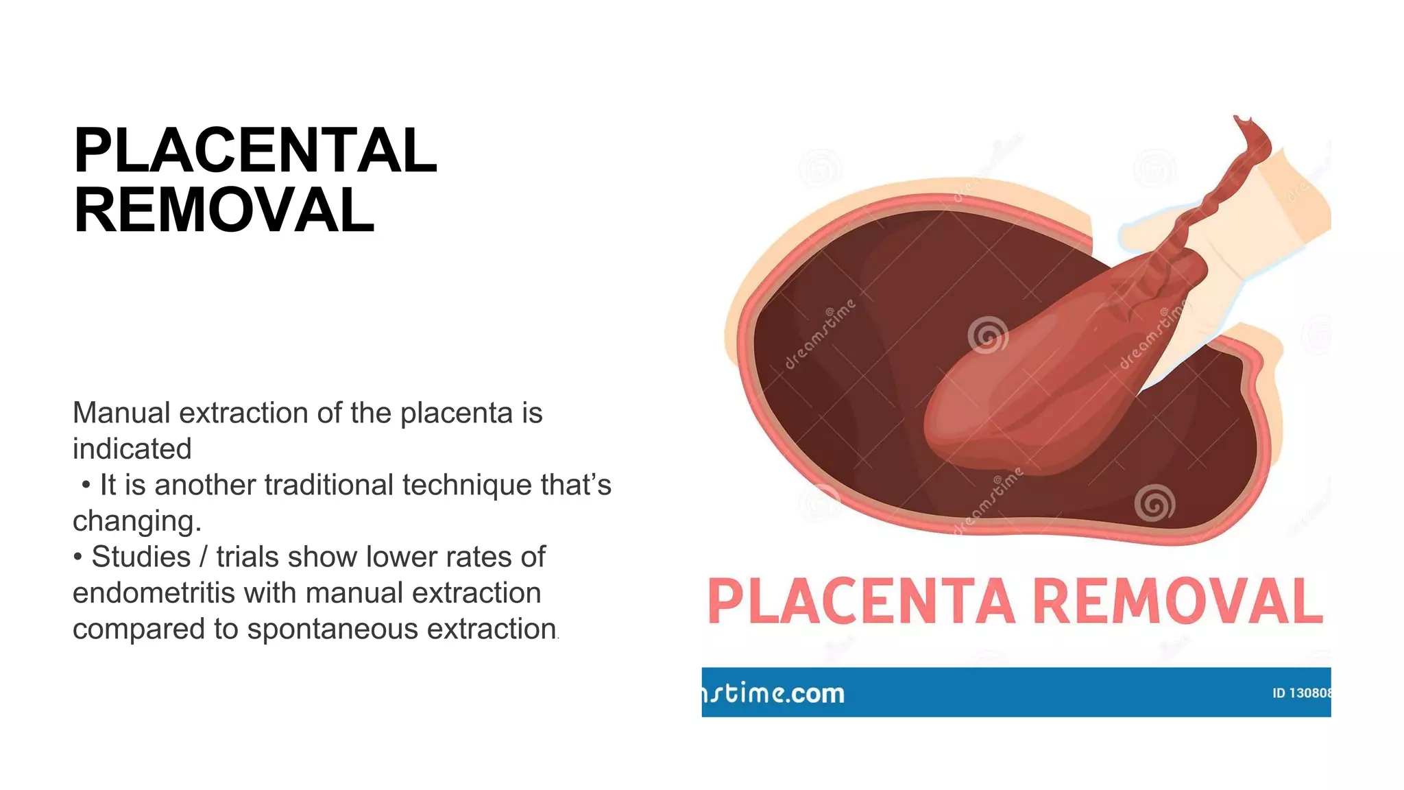 cesarean section.pptx