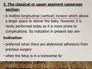 CESAREAN SECTION.pptx