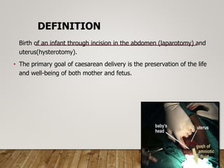 CESAREAN SECTION.pptx