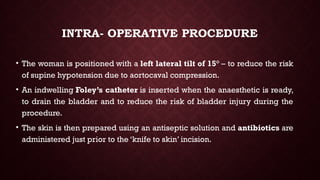 CESAREAN SECTION / OPERATIVE OBSTETRICS.pptx