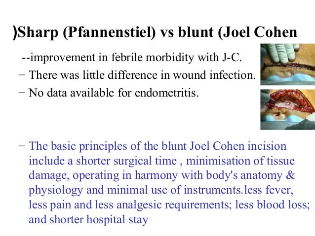 Cesarean section hennawy