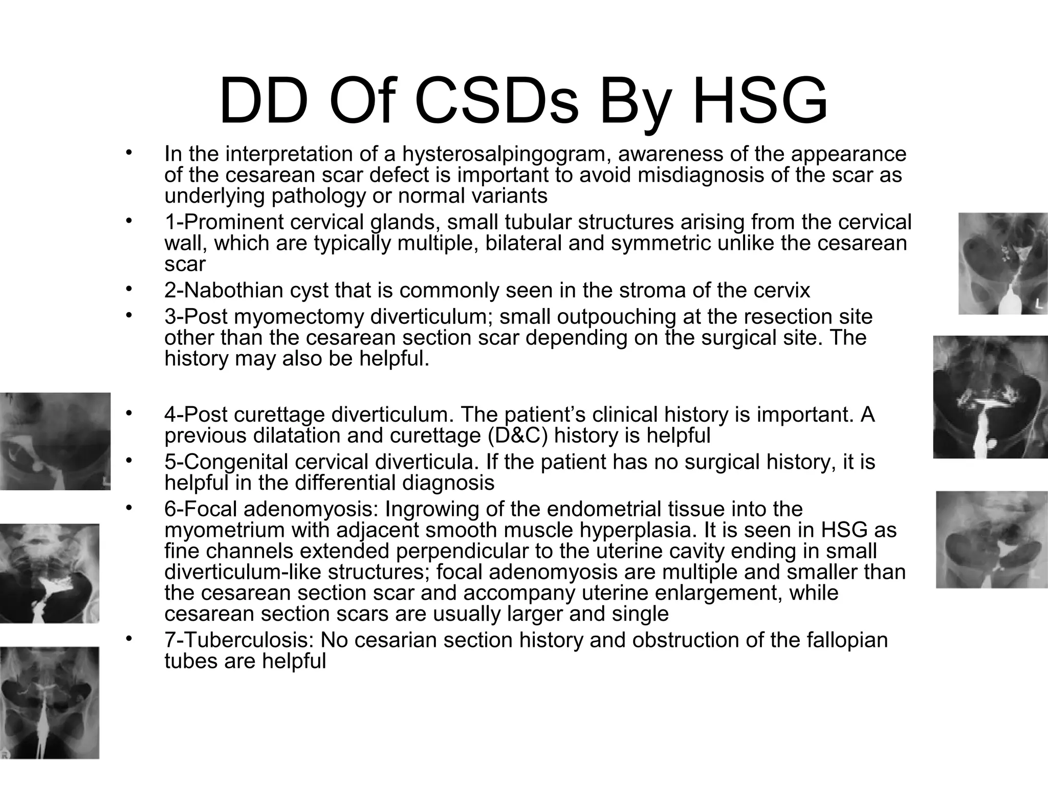 Cesareansectionscardefects | PPT