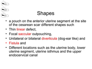 Cesareansectionscardefects | PPT