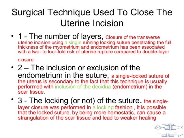 Cesareansectionscardefects