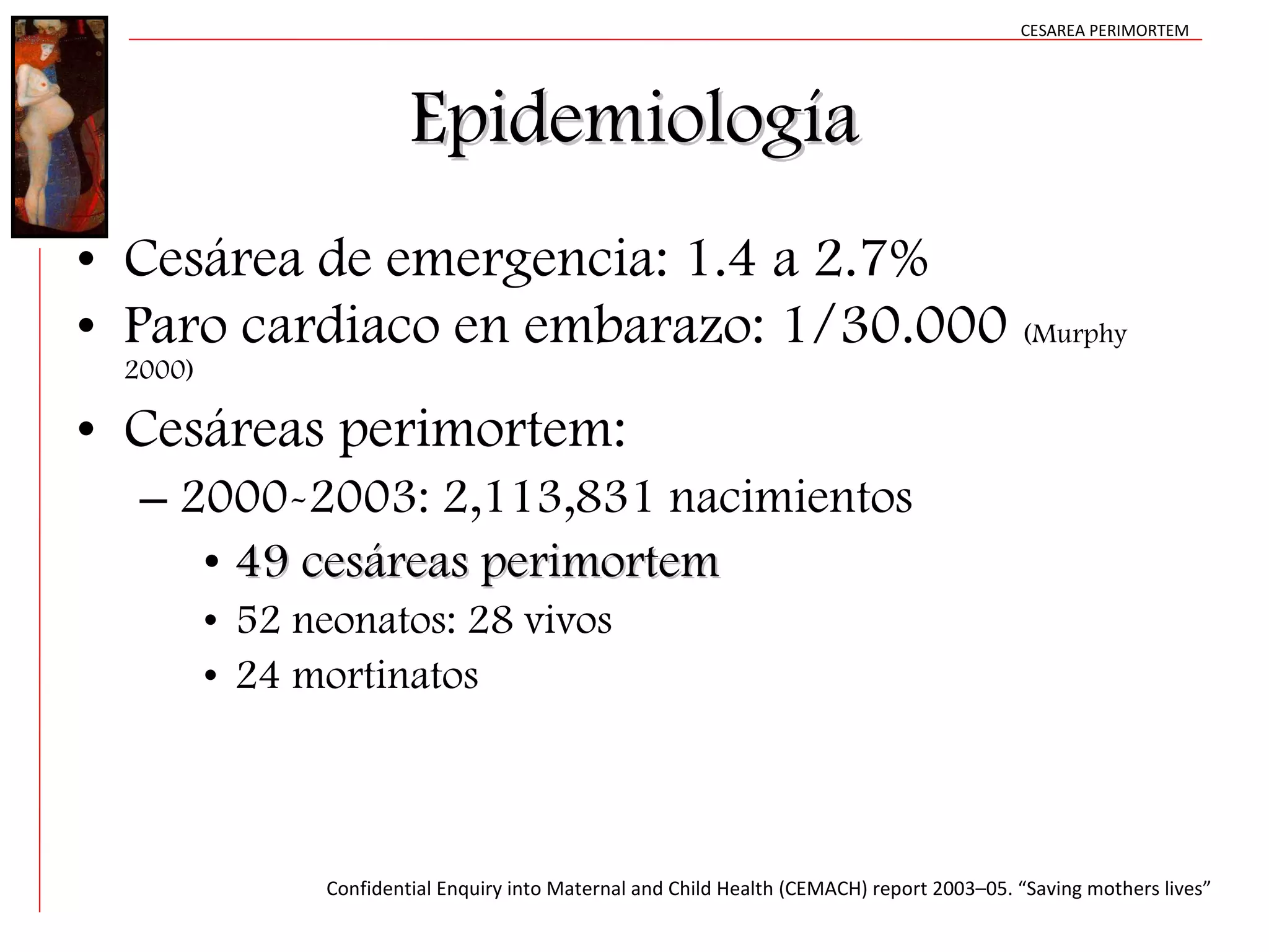 Cesarea perimortem | PPT