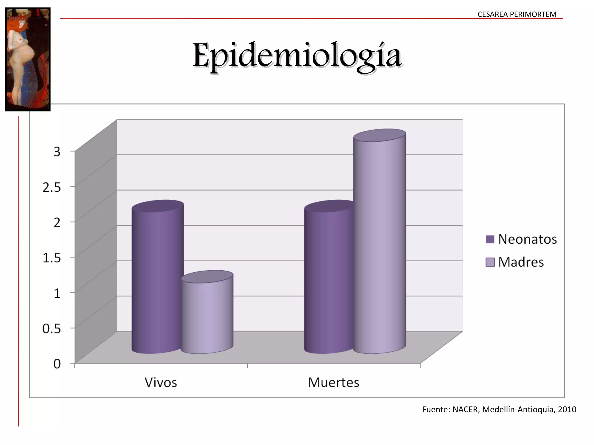 Cesarea perimortem | PPT