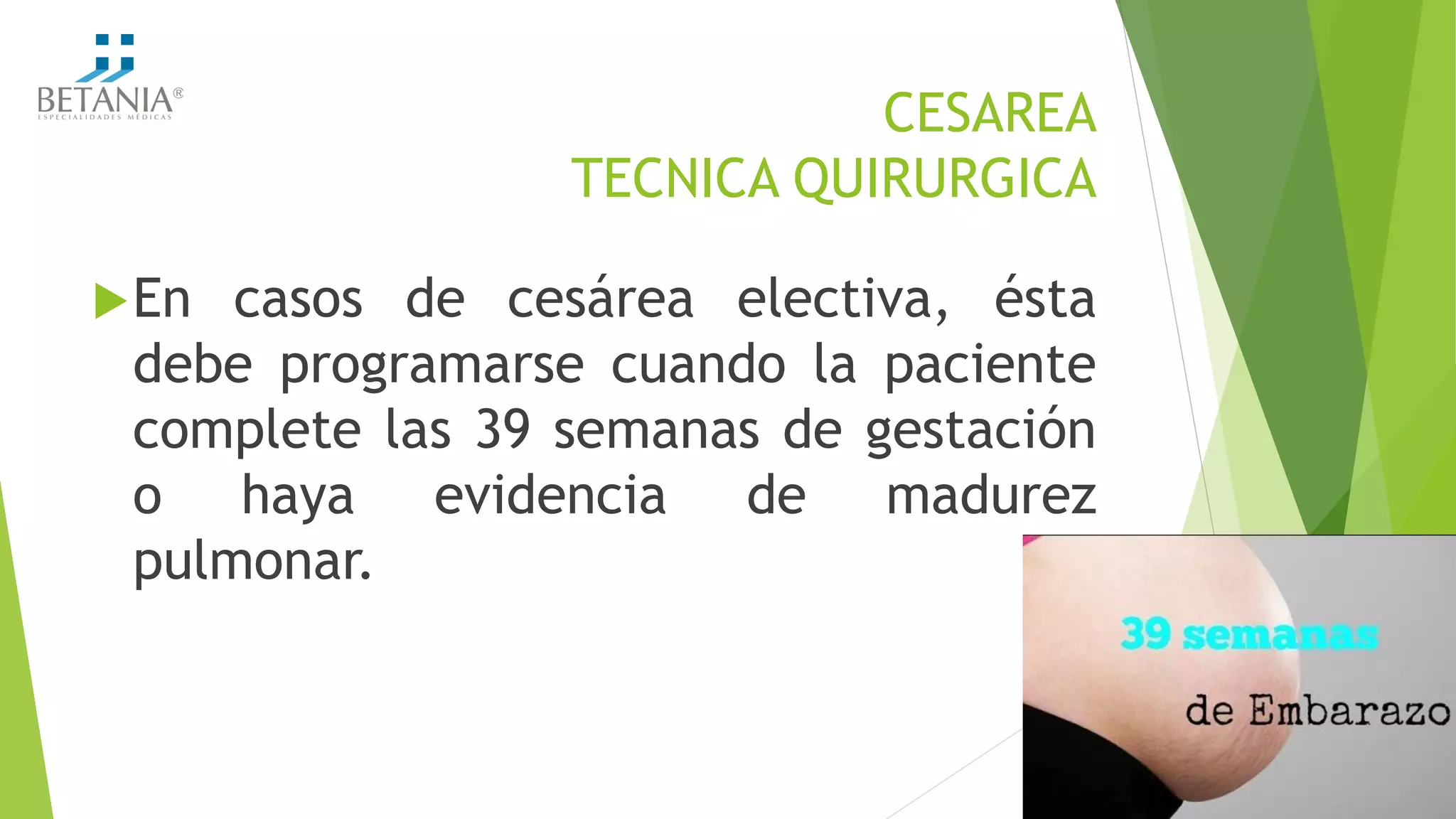 Cesarea tecnica quirurgica | PDF
