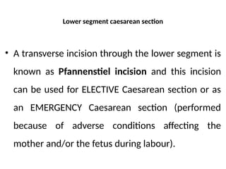 CESARIAN SECTION FOR STUDENTS NUSES.pptx