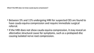 diagnosis of cauda equina syndrome in ER | PPTX