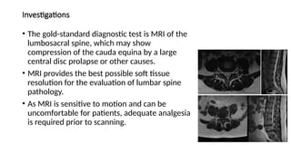 diagnosis of cauda equina syndrome in ER | PPTX