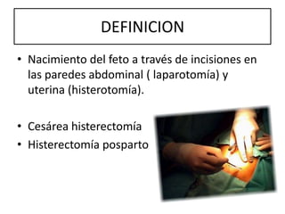 CESAREA | PPTX