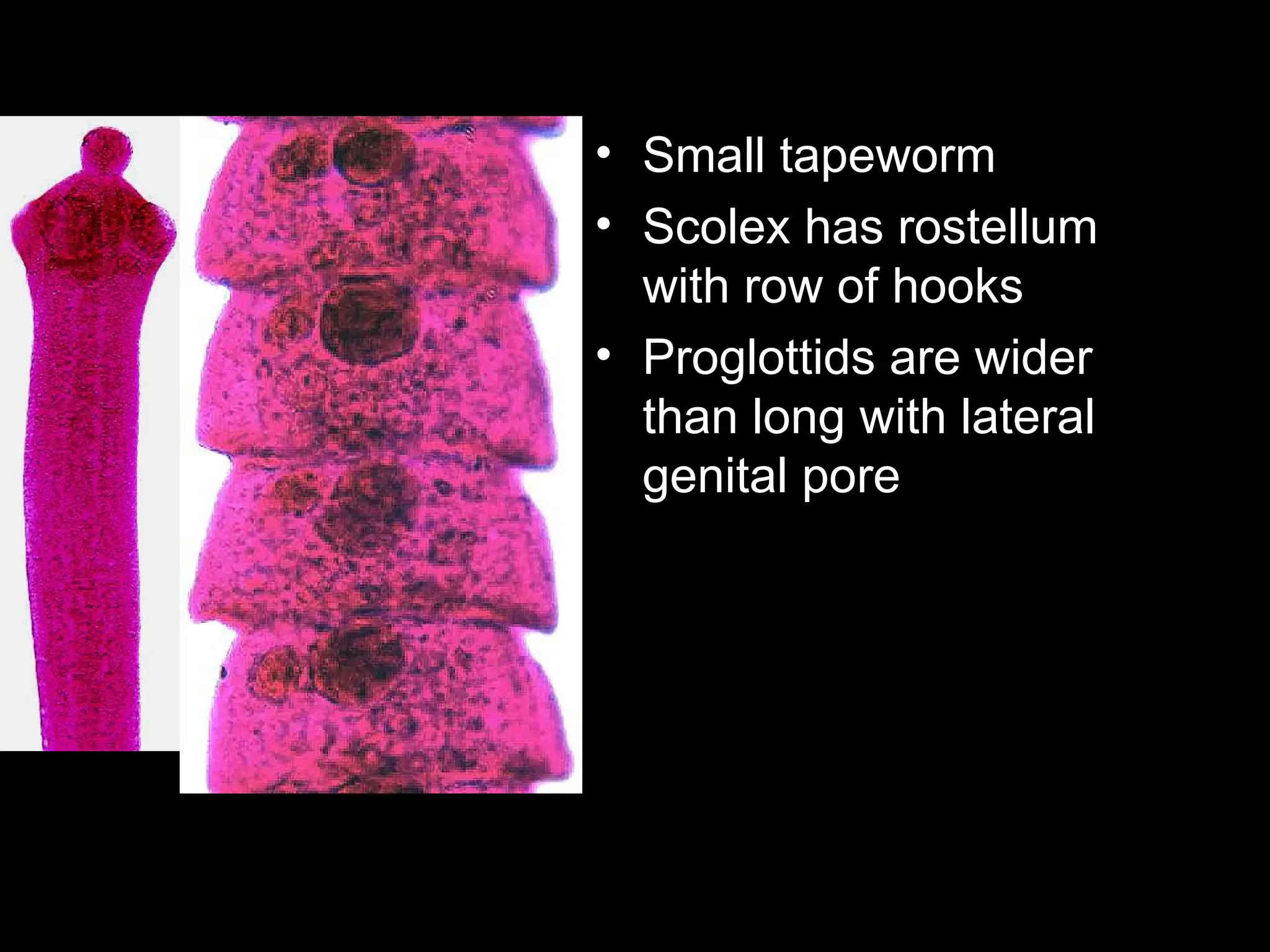 Cestodes by Dr. KennedyMunisi MD. MMed. Msc.ppt