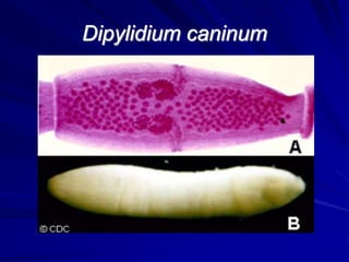 Dipylidium Slide Labeled