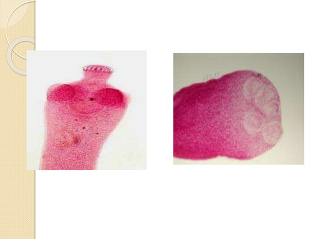 Cestodes and trematodes | PPTX