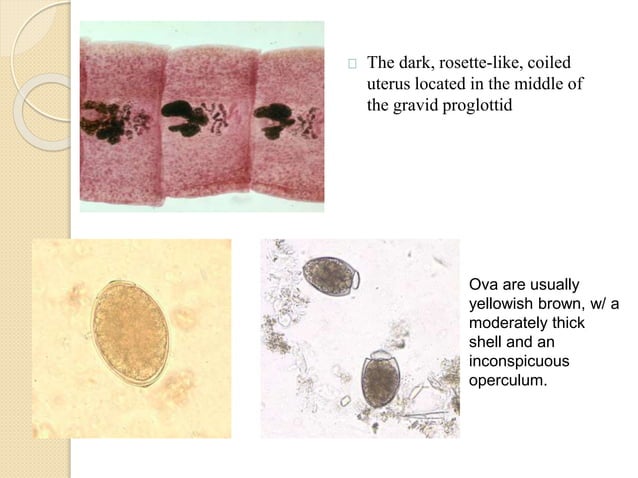 Cestodes and trematodes | PPTX