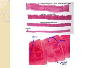 Cestodes and trematodes | PPTX
