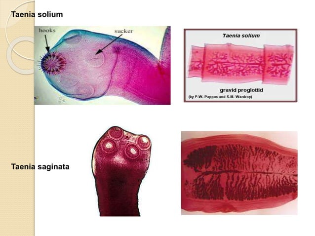 Cestodes and trematodes