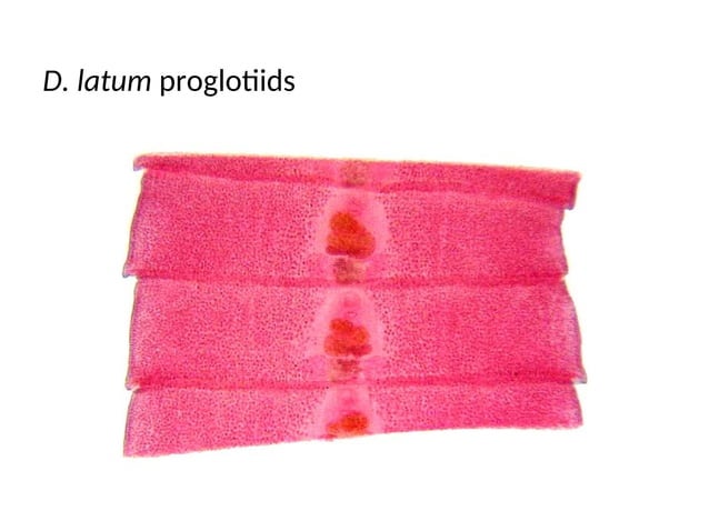 Cestodes projection slides for practical learning purpose | PPT